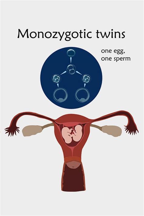 Monozygotic Identical Twins Facts And Misconceptions