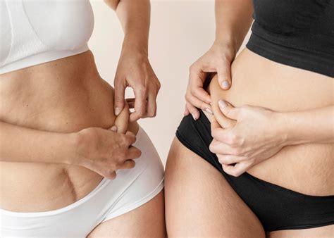 Lipoescultura Sin Cirugía ¡adiós A La Grasa Localizada Sin Bisturí