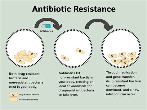 Insights Into Editorial The Cost Of Antimicrobial Resistance