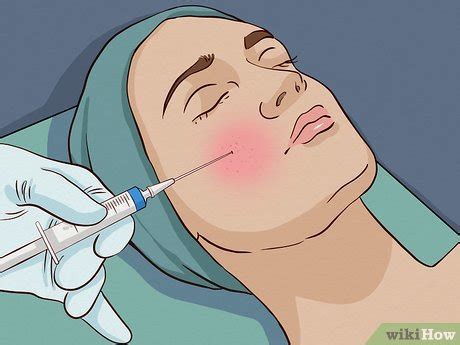 Ways To Get Rid Of Acne Redness WikiHow Life Ways To Get Rid Of Acne Redness WikiHow Life