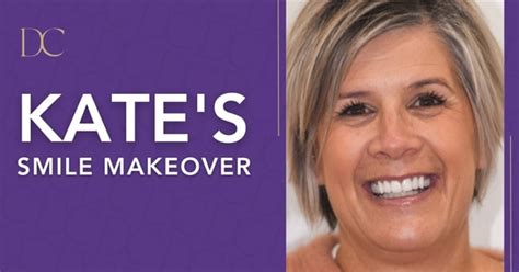 Kates Porcelain Veneers In Bacchus Marsh Dental Couture