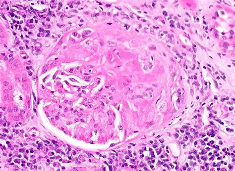 Nat Pernick On Linkedin This Essay Discusses The Movement To Abandon Medical Terminology Named