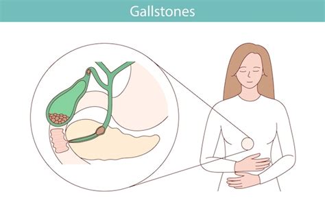 Premium Vector Schematic Vector Illustration Of The Structure Of The