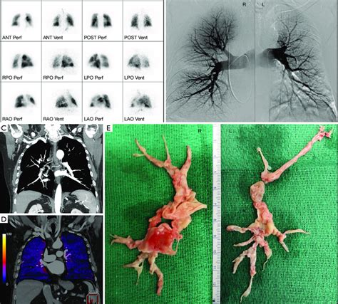 Imaging Modalities And Resection Specimens From A Single Patient A Download Scientific