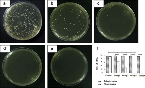 Antibacterial Effects Of Different Irrigation Protocols Against E