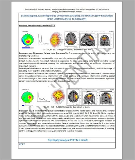 Qeeg Erp Vcpt Report Full Mitsar Neurodiagnostics Electroencephalography Eeg