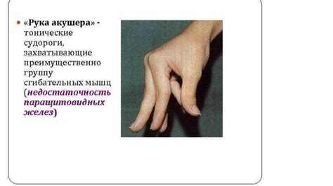 Семиотика болезней органов эндокринной системы Online Presentation