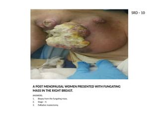 Osce Revised Ppt For University Examspptx