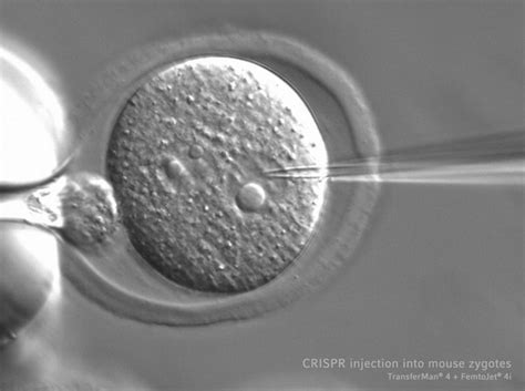 Microinjectors Femtojet® 4i And Femtojet® 4x Calibre Scientific Cell Manipulation Research