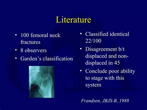 G06 Fracture Classification Ppt Death Injury Or Military Conflict