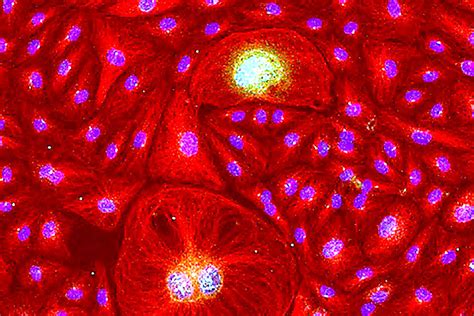 What Are Senescent Or Aged Cells Centenary Institute