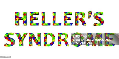 Hellers Syndrome Conceptual Illustration High Res Vector Graphic
