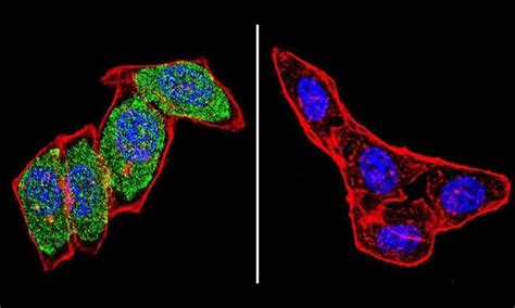 Evaluation Of The Er Alpha Expression Mrna And Protein After Des
