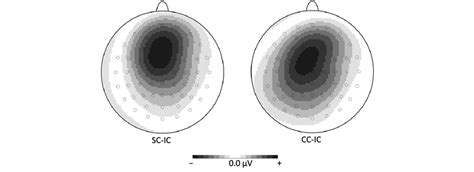 The Scalp Topography For The SC IC Difference Left And The Scalp Download Scientific Diagram