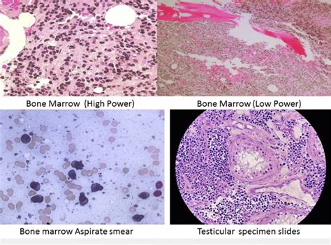 Figure Showing The Histological Slides Of Bone Marrow And Testicular