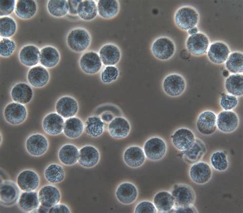 Polymorphonuclear Leukocytes With The Typical Granular Cytoplasm And