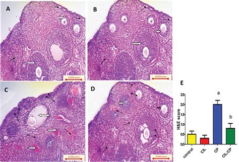 Histopathology Of Ovarian Tissue Photomicrographs Of Ovarian Sections