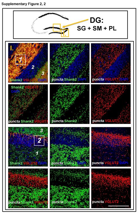 Selective Localization Of Shanks To Vglut1 Positive Excitatory Synapses