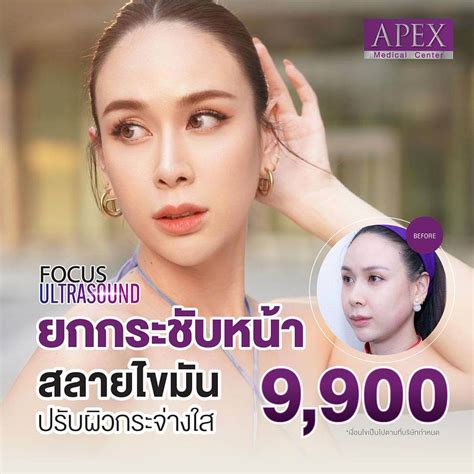 Apex Wellness Elite Card Apex Profound Beauty