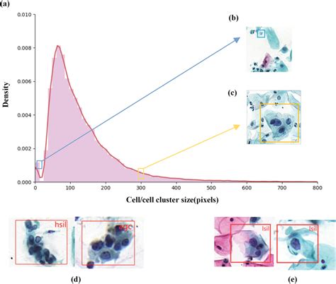 description of abnormal cervical cells in the comparison detector