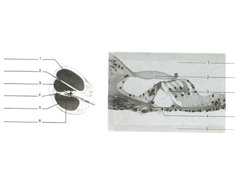 Anat 215 Cochlea Quiz