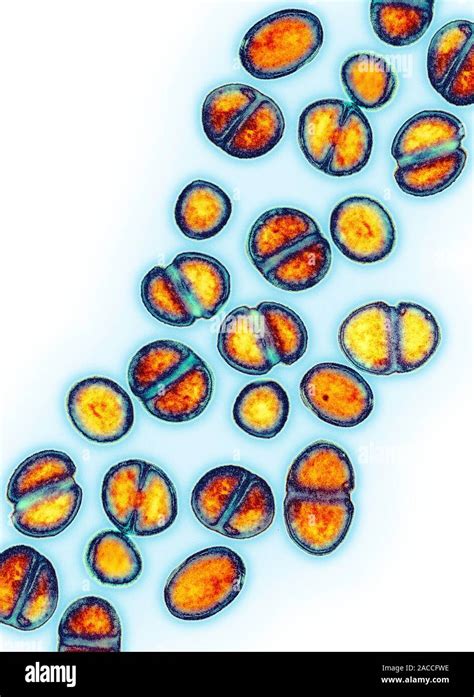 Mrsa Bacteria Coloured Transmission Electron Micrograph Tem Of
