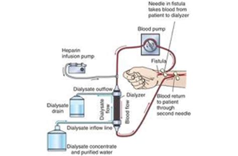 Apheresis