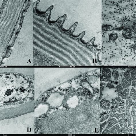 Ultrastructure Of Aedes Aegypti Larvae L3 Treated With The Substance Download Scientific