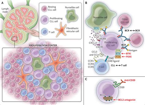 Pathogenesis Of Chronic Lymphocytic Leukemia
