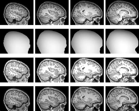 Figure 6 From A Robust Parametric Method For Bias Field Estimation And