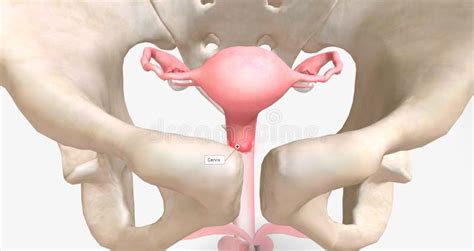 Chlamydia Is A Sexually Transmitted Infection Caused By Chlamydia Trachomatis Bacteria Stock