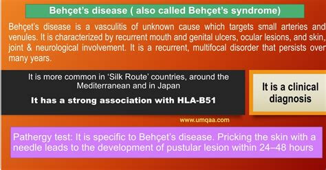 What Are The Diagnostic Criteria For Behçets Disease