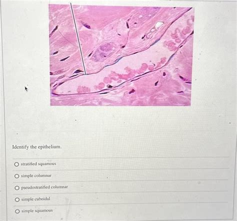 solved identify the epithelium stratified squamous simple
