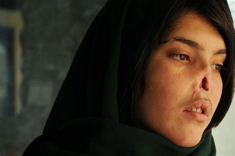 Afghan Nose Cut Off Lady