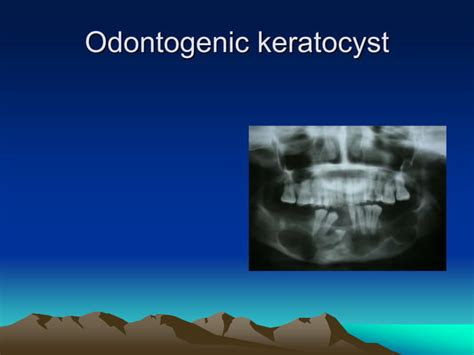 1 Intro To Cyst Classification And Pathophysiology Ppt