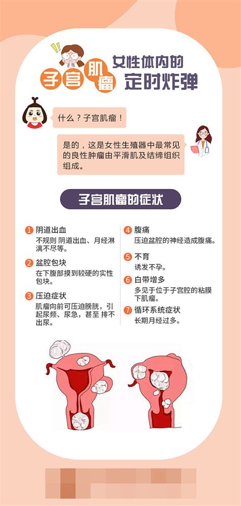 子宫肌瘤的症状