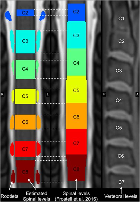 Automatic Segmentation Of The Spinal Cord Nerve Rootlets Imaging Neuroscience Mit Press