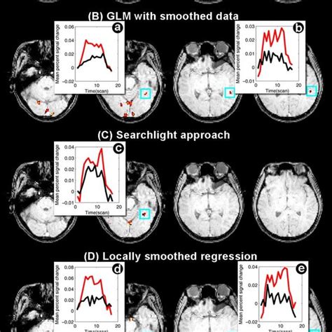 Functional Brain Mapping Of One Participant Using A General Linear Download Scientific