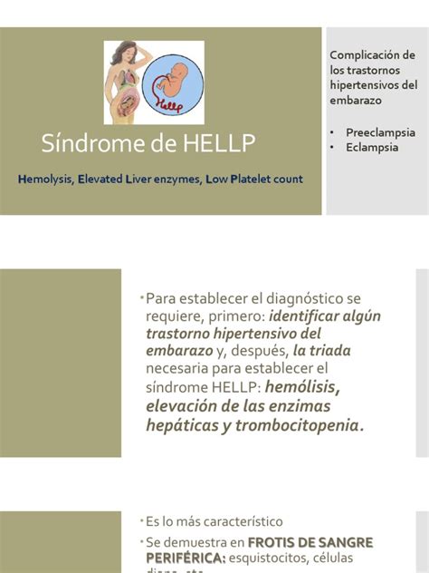Diagnóstico Y Tratamiento Del Síndrome Hellp Pdf Enfermedades Y