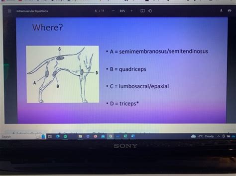 Intramuscular Injections IM Flashcards Quizlet