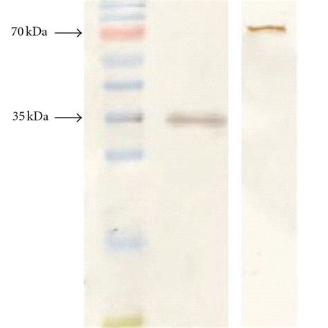 Sds Page Analysis Of Purified Soluble Pyrophosphatase Mthe 0236 And Download Scientific