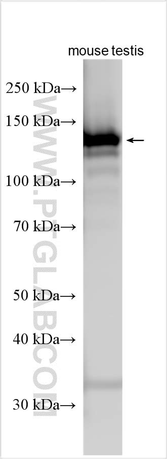 Cd117 C Kit Antibody 31337 1 Ap Proteintech