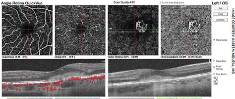 Ophthalmology Management Pentavision