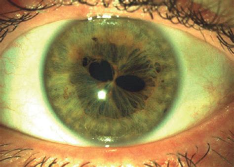 632 Best Optometry Images On Pholder Optometry Mildlyinteresting And