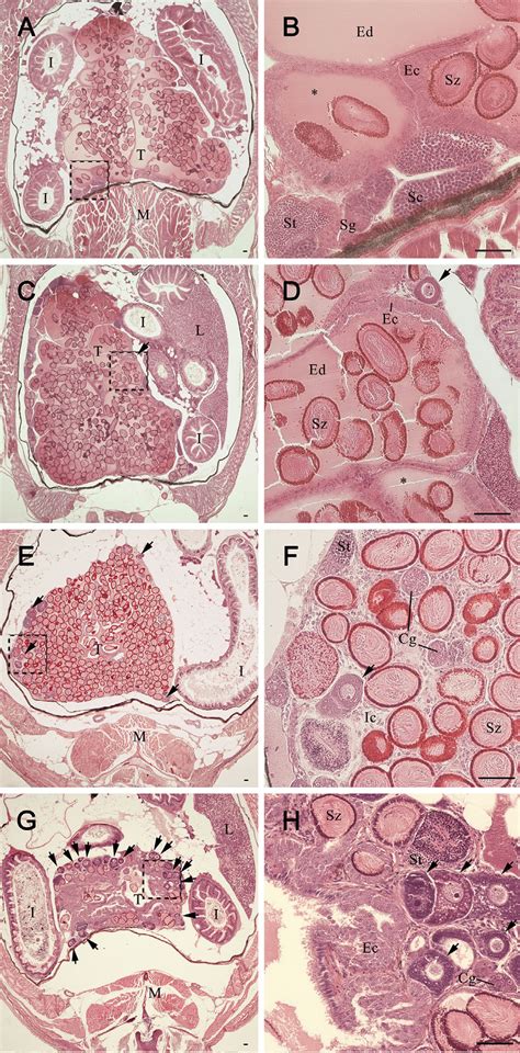 Illustrative Images With Hematoxylineosin Staining Of Testicular