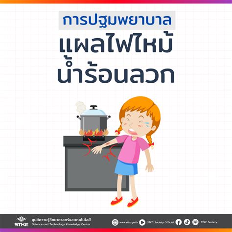 การปฐมพยาบาลแผลไฟไหม้ น้ำร้อนลวก Science And Technology Knowledge Centre Stkc