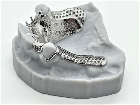Partial Frame May Dental Technology Coltd
