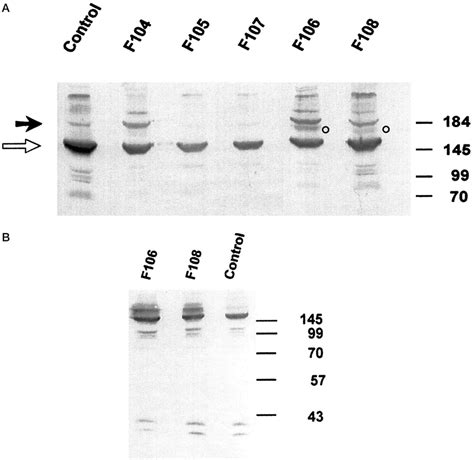 Western Blot Analysis Of Factor H And Factor H Related Proteins In Download Scientific Diagram
