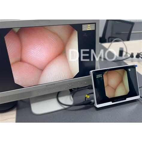 High Quality Flexible Video Cystoscope Cystonephroscope Bladder