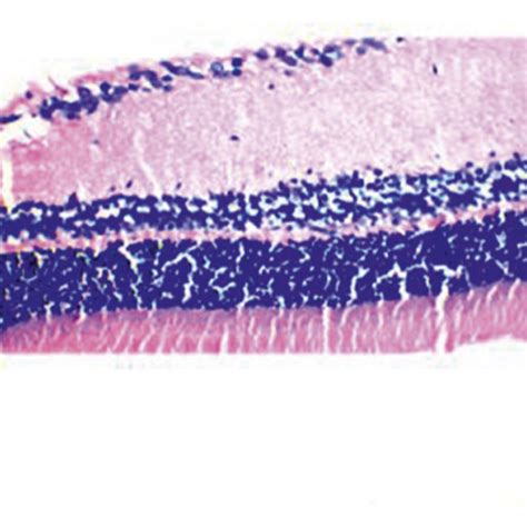 Observation Of The Retinal Structure Of Each Group By He Staining